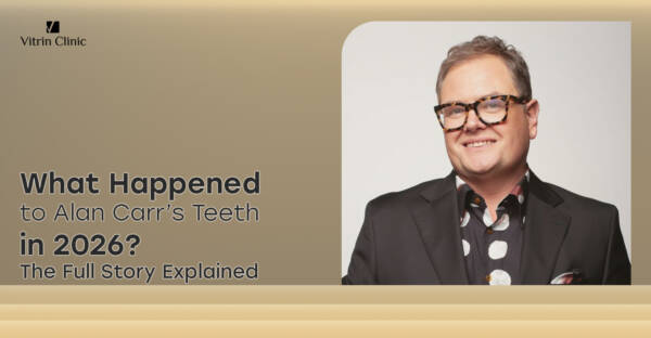 What Really Happened to Alan Carr Teeth in 2026? The Shocking Truth ...