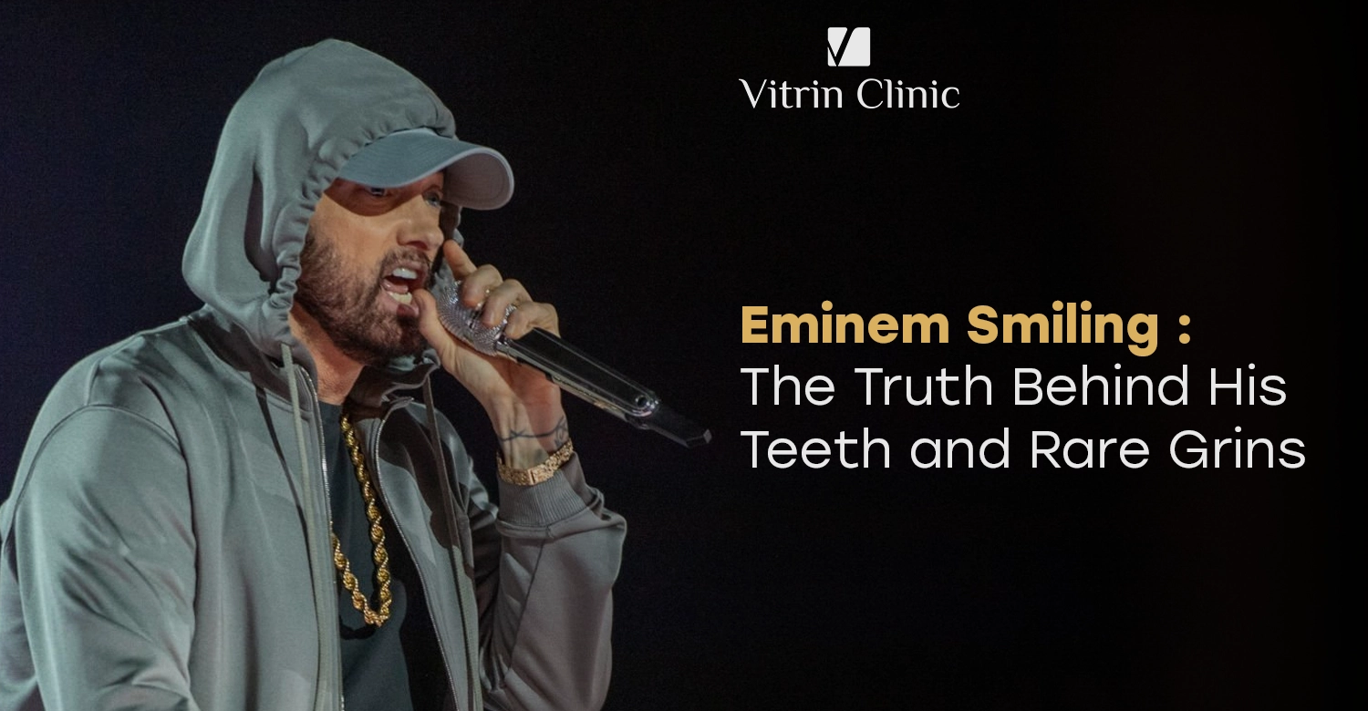 Eminem Smiling: His Rare and Iconic Grin - vitrinclinic
