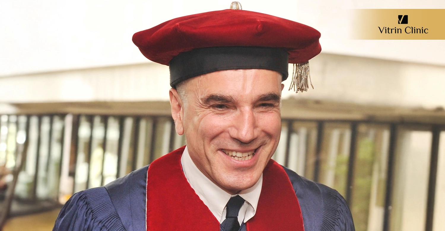 Daniel Day-Lewis Teeth: How His Smile Evolved - Vitrinclinic