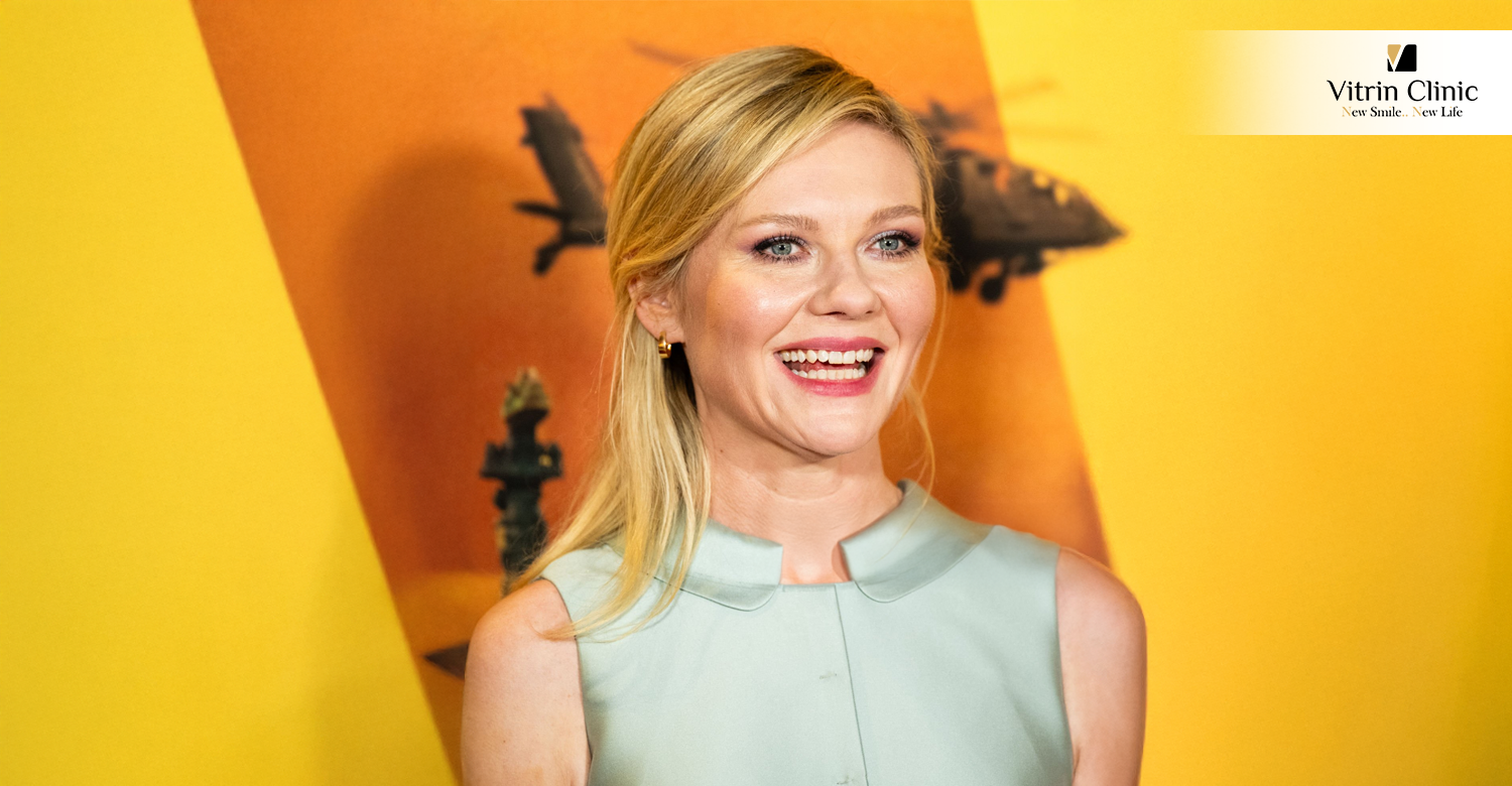 Kirsten Dunst Teeth: The $100K Spider-Man Star's Smile Journey