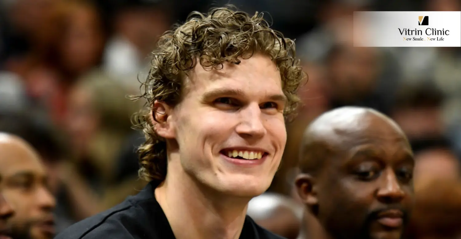 Lauri Markkanen Teeth: NBA Star's Smile & Dental Features