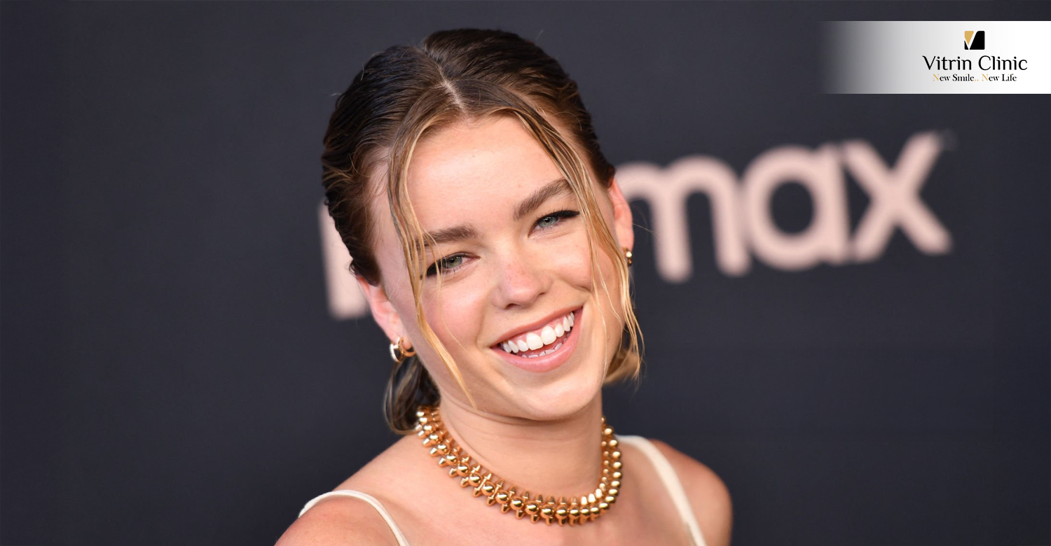 Milly Alcock Teeth: House of the Dragon Star's $35K Smile