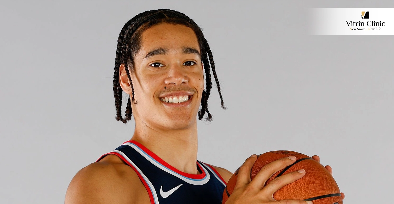 Yanic Konan Niederhauser Teeth: 3 Keys to a Model's Globally