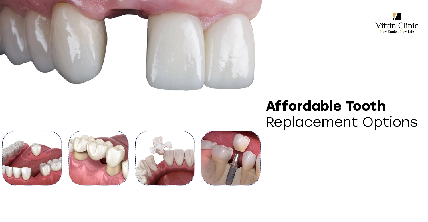 6 Affordable Tooth Replacement Options 2026 (Costs Compared)