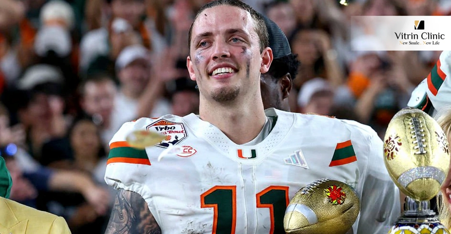 From Ordinary to Stunning Carson Beck teeth Transformation! - Vitrin Clinic