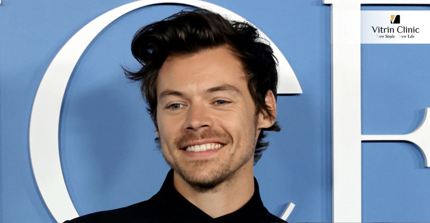 Harry Styles Smile: The 3-Part Formula to Its Iconic Charm | VitrinClinic
